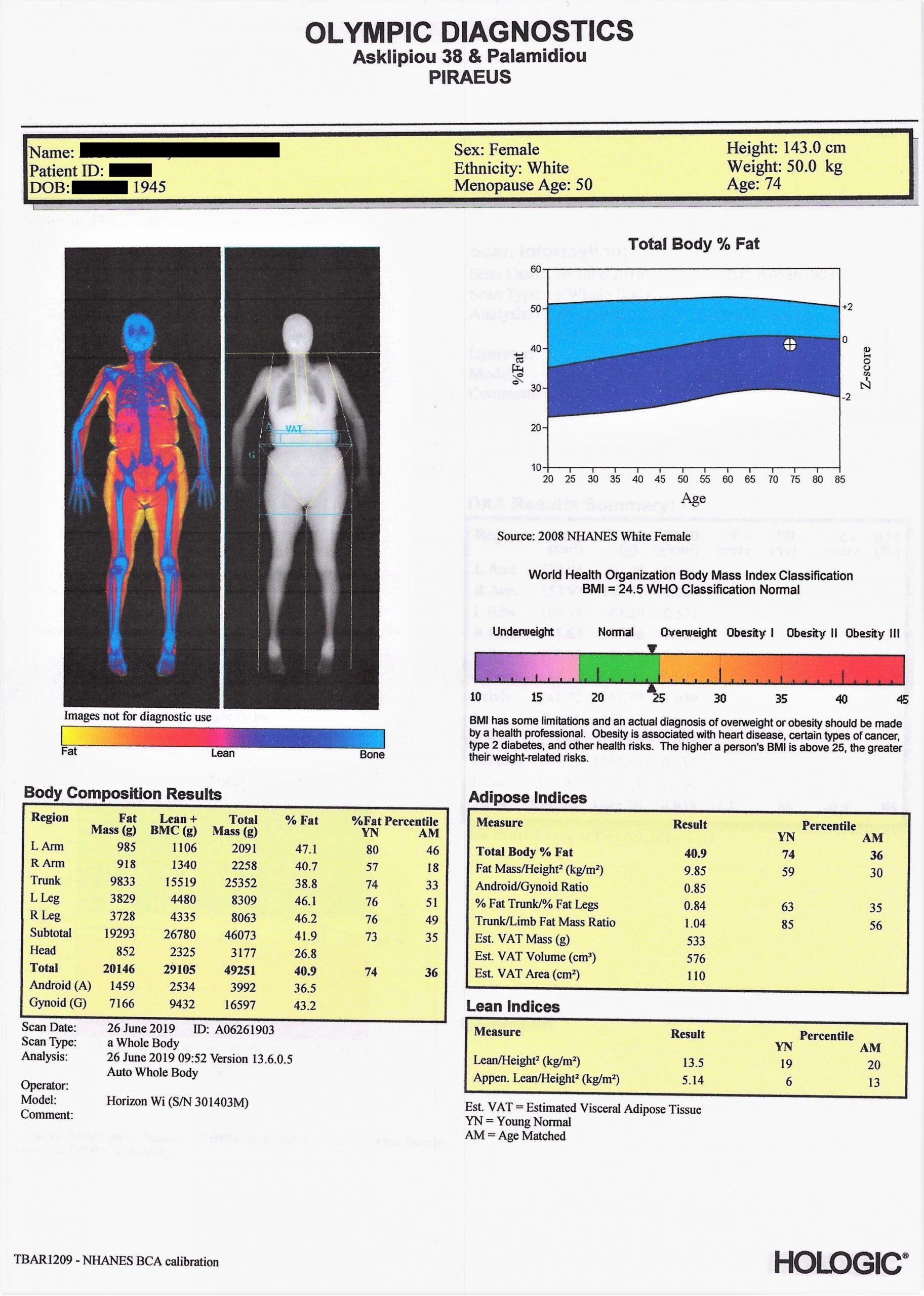 Bone Densitometer - Olympic Diagnostic