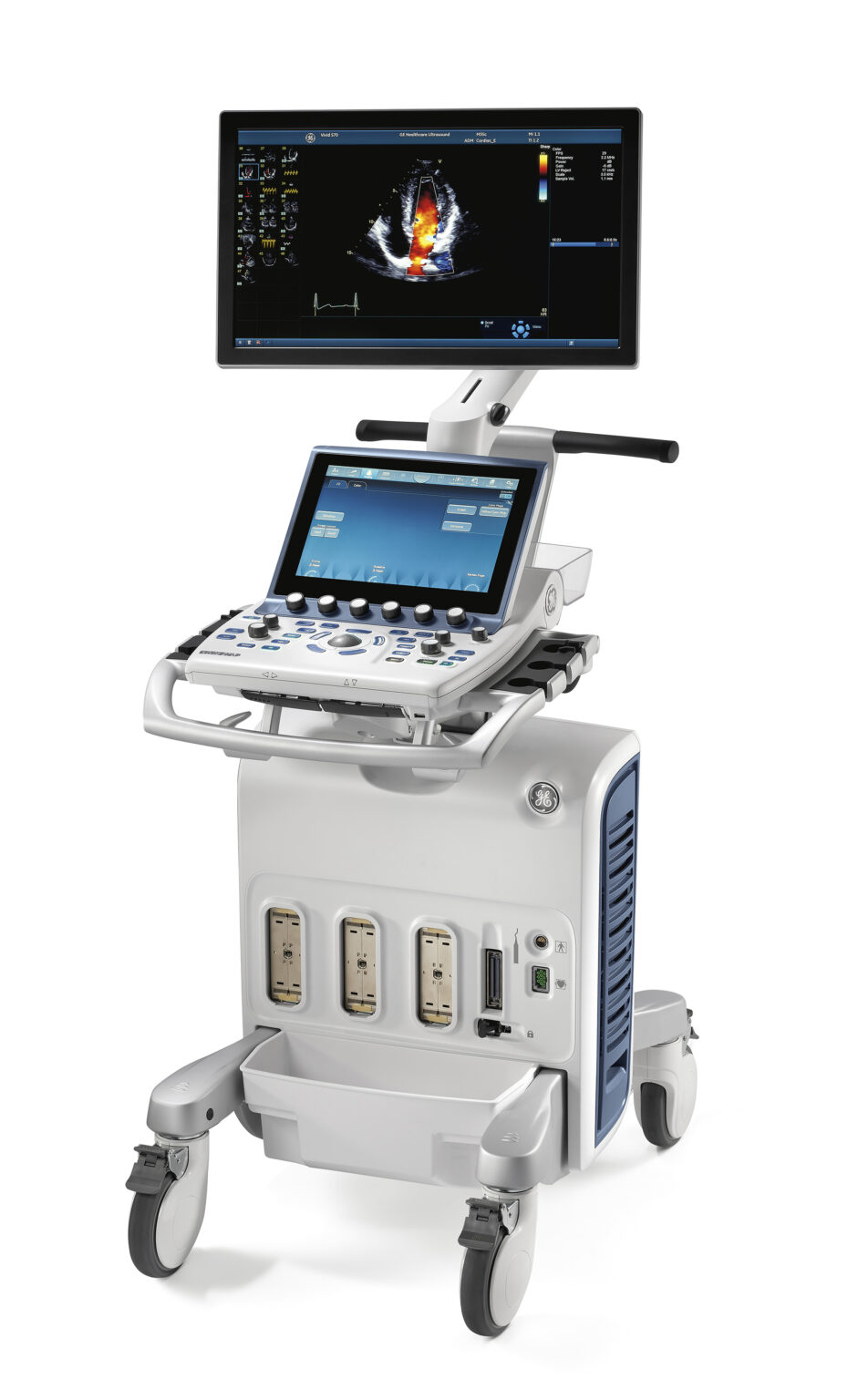 Stress Echo - Olympic Diagnostic